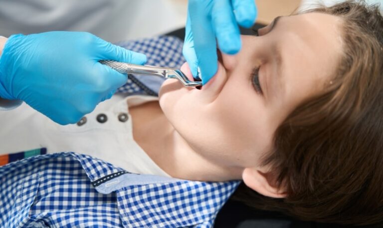 Understanding the Impact of Tooth Extraction on Other Teeth
